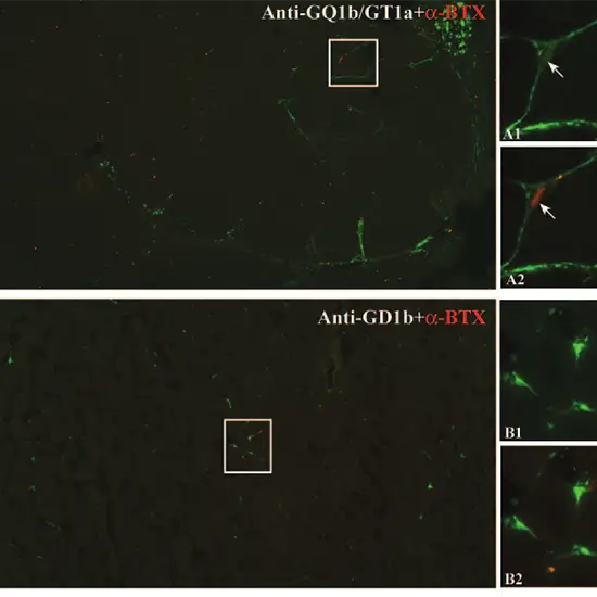 Ganglioside GD1b Antibody, IgM Test Near You in Delhi | Book Test at ...