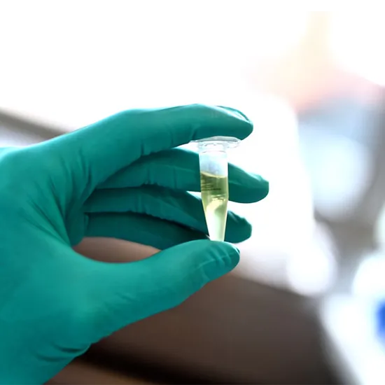 Book CSF Protein | Test Price In Delhi | Ganesh Diagnostic