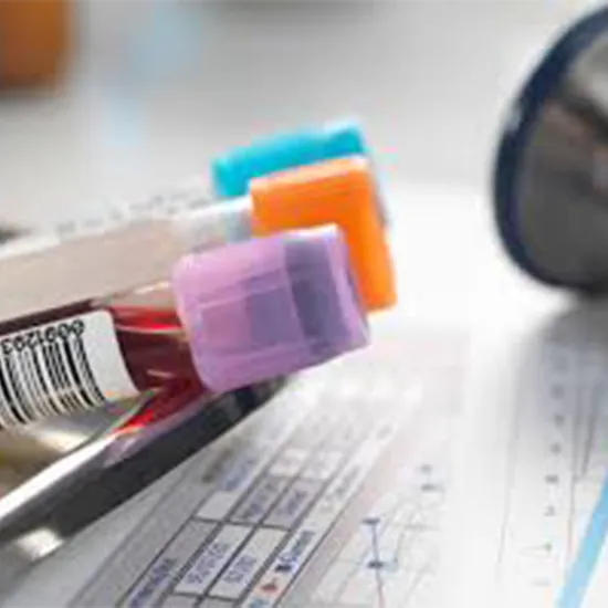 Book Blood Lead Levels | Test Price In Delhi | Cost Near Me, India ...