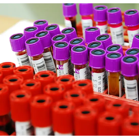 C2 Complement Component Test Near You in Delhi | Book Test at Low Price