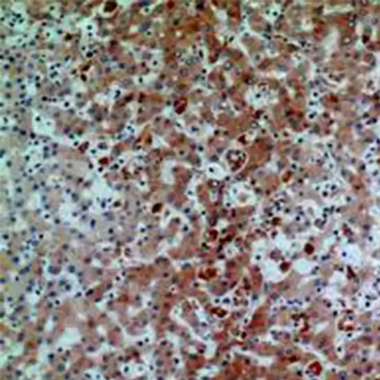 Complement Component C7 | Test Price In Delhi | Cost Near Me, India ...