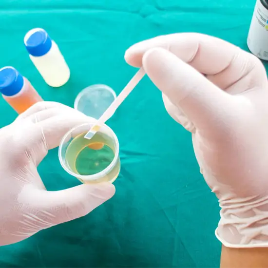 Bilirubin Fluid | Test Price In Delhi | Cost Near Me, India | Ganesh ...