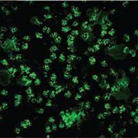 Direct Immunofluorescence | Test In Delhi | Cost Near Me, India ...