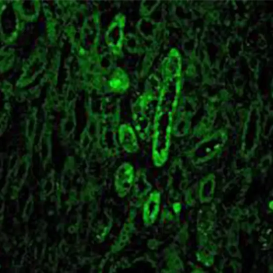 Complement Component 1q C1q | Test Price in Delhi | Ganesh Diagnostic