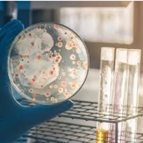 Book Culture Anaerobic Bacteria | Test Price In Delhi | Ganesh Diagnostic