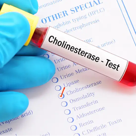 Cholinesterase Serum Cost in Delhi Test Price Near Me, India | GDIC