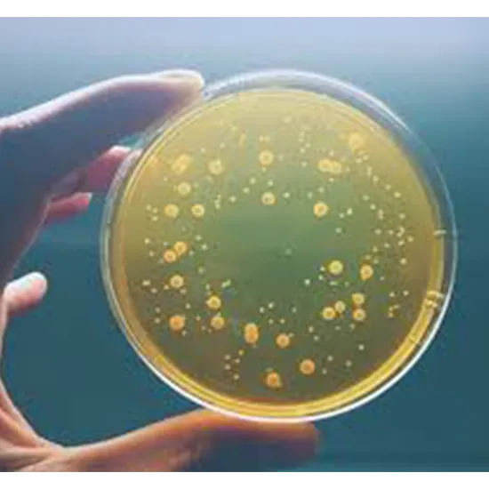 Culture Aerobic Bacterial | Test Price in Delhi | Ganesh Diagnostic