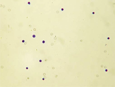 Chyle Examination | Test Price In Delhi | Cost Near Me, India | Ganesh ...