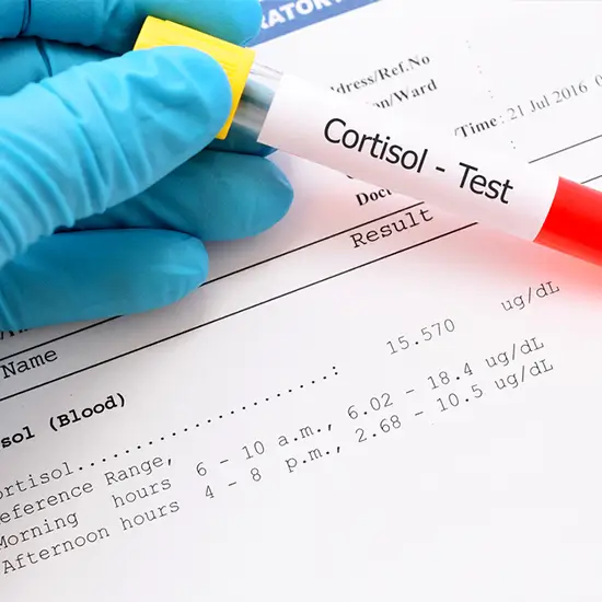 Book Cortisol Dexamethasone Suppression | Test Price In Delhi | Ganesh ...