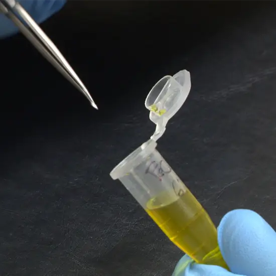 Ferric Chloride Urine | Test Price In Delhi | Cost Near Me, India ...