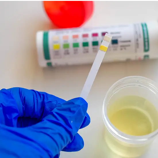 Book Electrolytes Random Urine | Test Price In Delhi | Ganesh Diagnostic