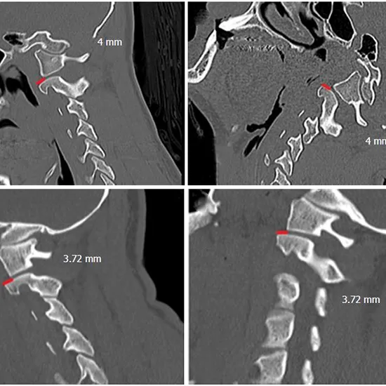MRI Screening CV Junction Test Near You in Delhi | Book Test at Low Price