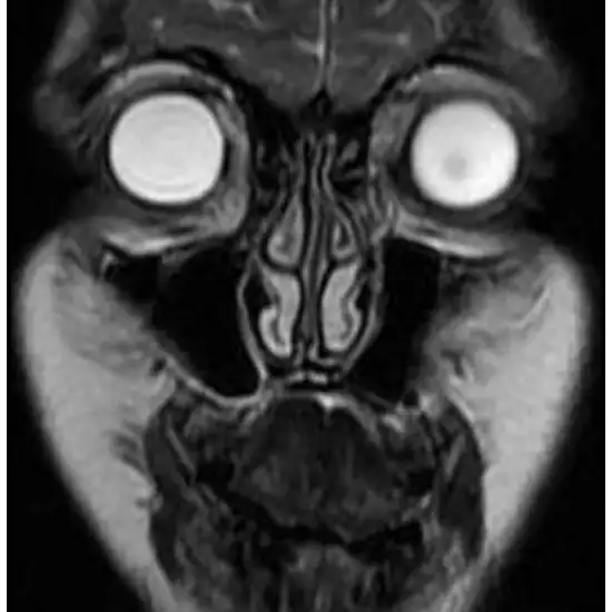 MRI Screening Of Face | Test Price in Delhi | Ganesh Diagnostic