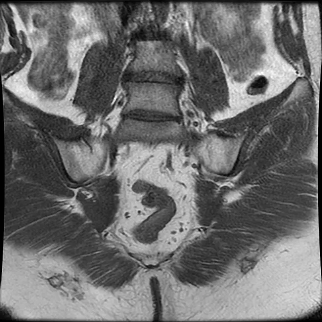 MRI SI Joints | Test Price in Delhi | Ganesh Diagnostic