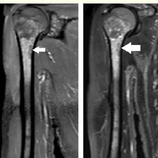 MRI Right Arm | Test Price In Delhi | Cost Near Me, India | Ganesh ...