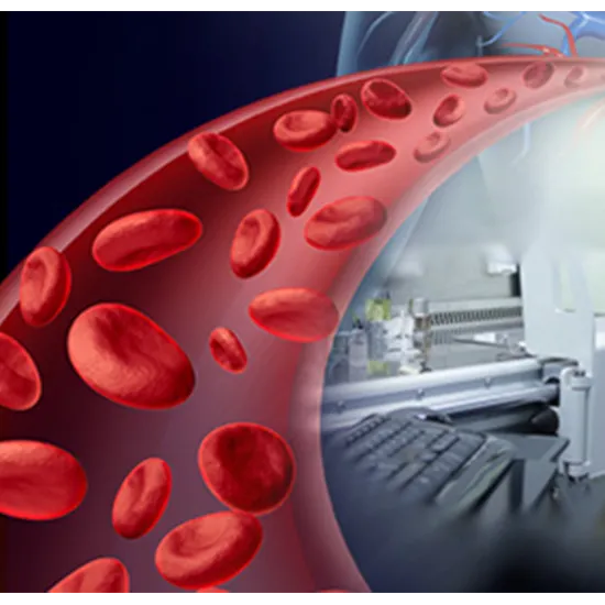 MUGA (Multigated Acquisition) Radionuclide Ventriculography Test In ...