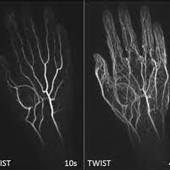 MR Angiography of Hand | Test Price in Delhi | Ganesh Diagnostic