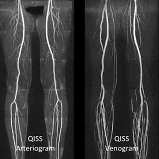 MR Bilateral Lower Limb Angiography Price in Delhi Test Cost Near Me ...