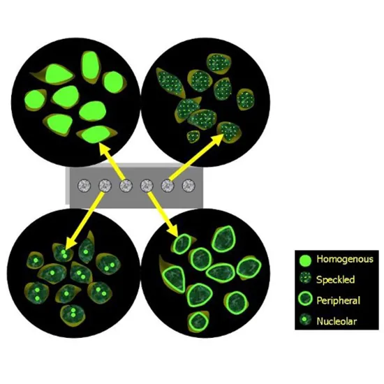 ENA Qualitative Antibodies Panel Cost in Delhi Test Price Near Me ...