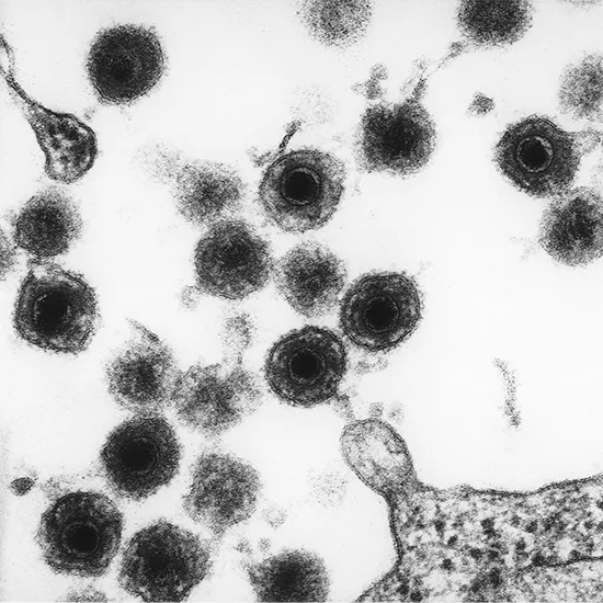 Epstein-Barr Virus Qualitative Cost in Delhi Test Price Near Me ...