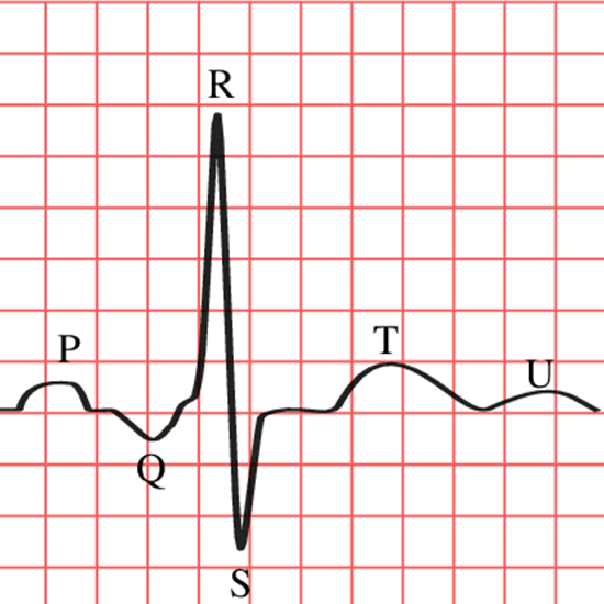 Long Lead II ECG | Test Price in Delhi | Ganesh Diagnostic