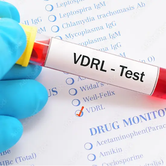 Book VDRL (CSF) | Test Price In Delhi | Cost Near Me, India | Ganesh ...