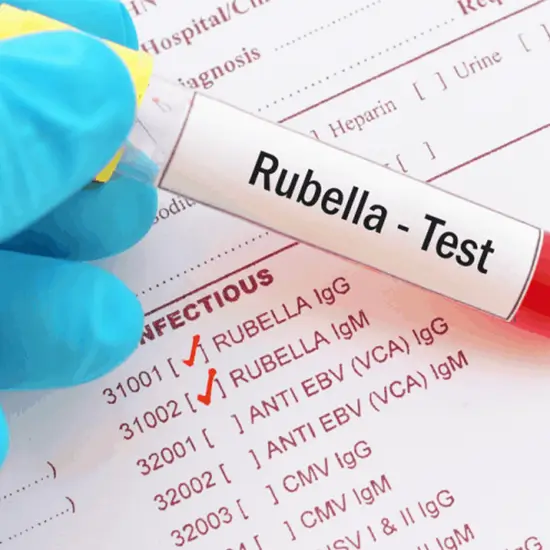 Rubella IgG | Test Price In Delhi | Price Near Me, India | Ganesh ...