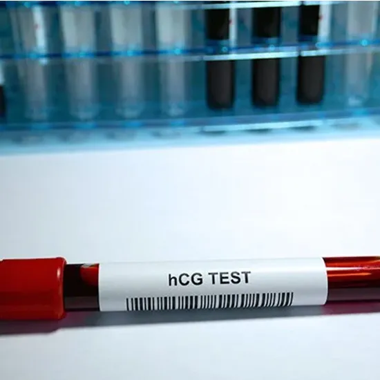 Beta (HCG) Human Chorionic Gonadotropin Test Near You in Delhi | Book ...