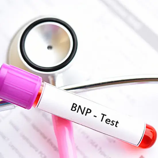 B-Type Natriuretic Peptide (BNP) | Test Cost In Delhi, India | Ganesh ...