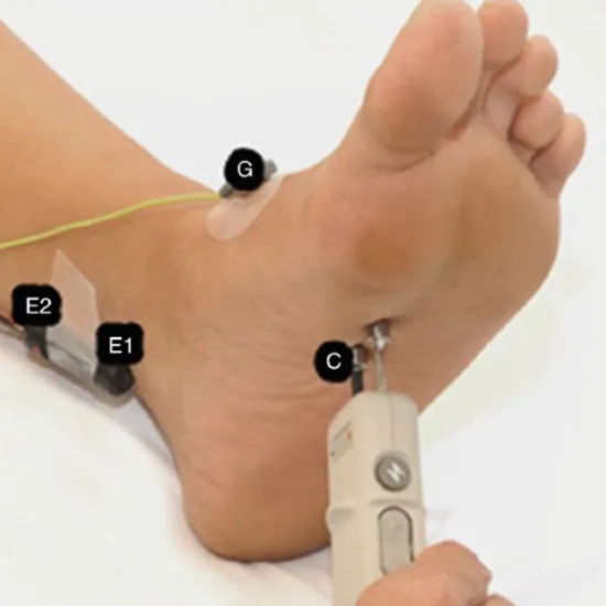 NCV Both Lower Limbs | Test Price In Delhi | Cost Near Me, India ...