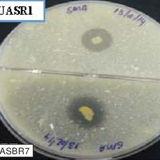 Milk Culture & Sensitivity | Test Price In Delhi | Cost Near Me, India ...