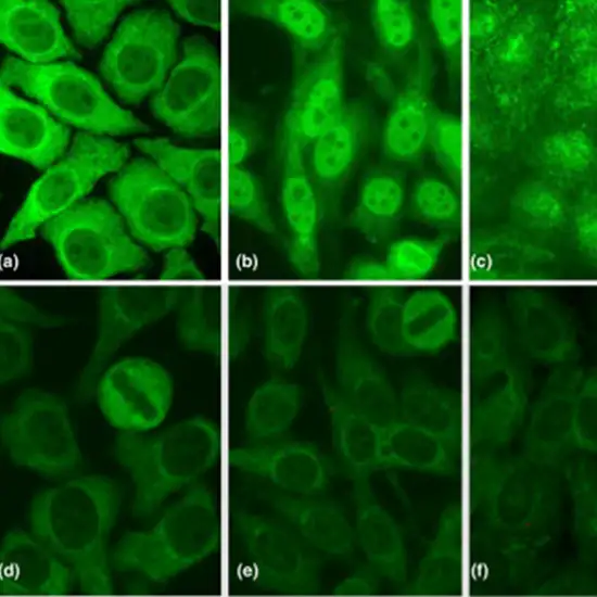 Ribosomal P Antibody Test Near You in Delhi | Book Test at Low Price