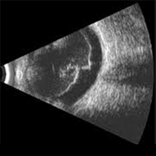 Bright (B Scan) Ultrasound Test Near You in Delhi | Book Test at Low Price