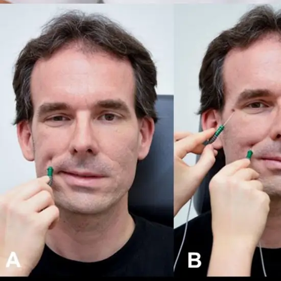 NCV (Nerve Conduction Velocity) Flat 20% OFF - NCV Test Centre Near You ...