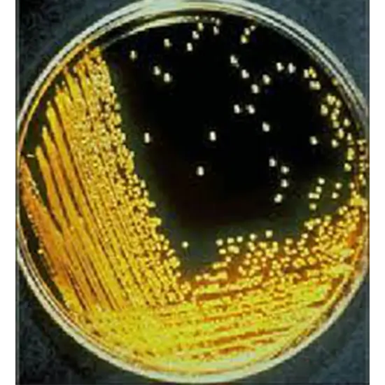 Book Culture Haemophilus | Test Price In Delhi | Ganesh Diagnostic