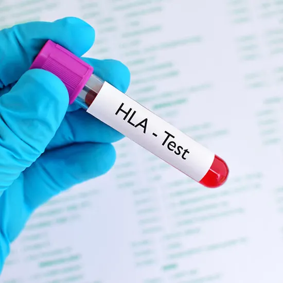 HLA-B5 Test Near You in Delhi | Book Test at Low Price