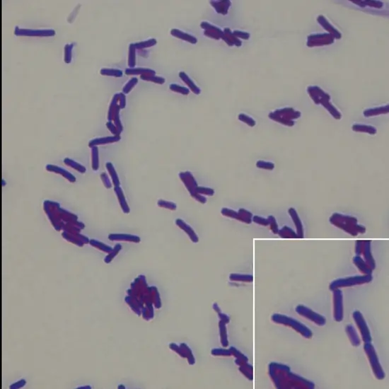 Genexpert Ultra (Next Generation) MTB PCR | Test Price In Delhi, India ...