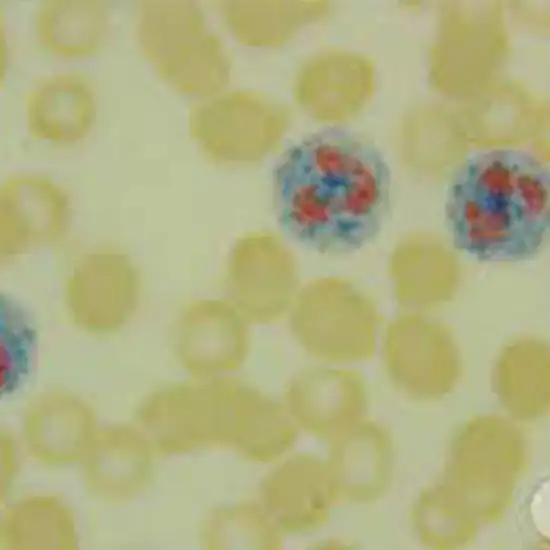 Leukocyte Alkaline Phosphatase (LAP) | Test Cost In Delhi, India ...