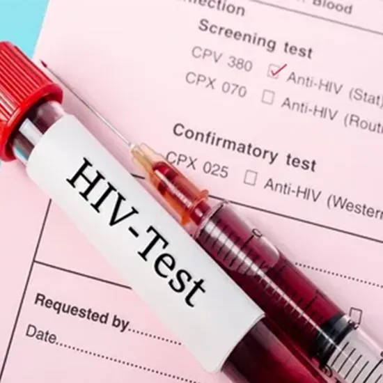 HIV-PCR (Polymerase Chain Reaction) | Test Cost In Delhi, India ...