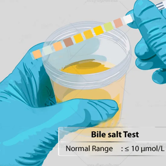 Bile Pigments | Test Price In Delhi | Cost Near Me, India | Ganesh ...