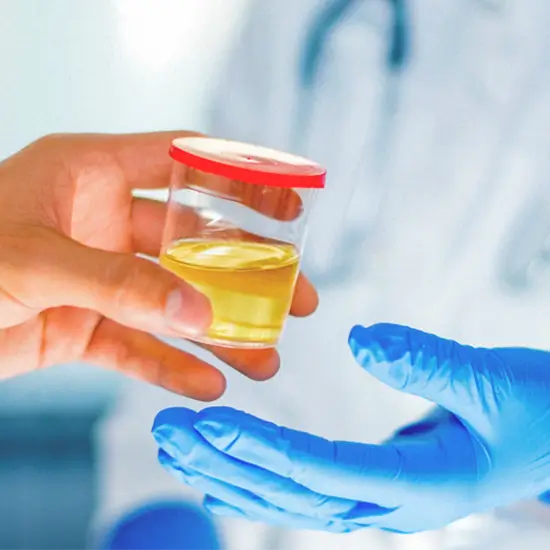 Bile Salts Test Near You in Delhi | Book Test at Low Price | Ganesh ...