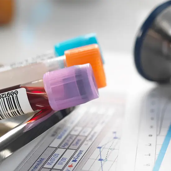 Book BLOOD C/S LACTATE 3 SAMPLES | Test Price In Delhi | Ganesh Diagnostic