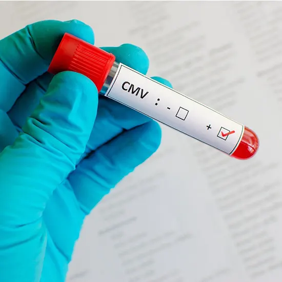 Cytomegalovirus (CMV) Qualitative PCR Test Near You in Delhi | Book ...