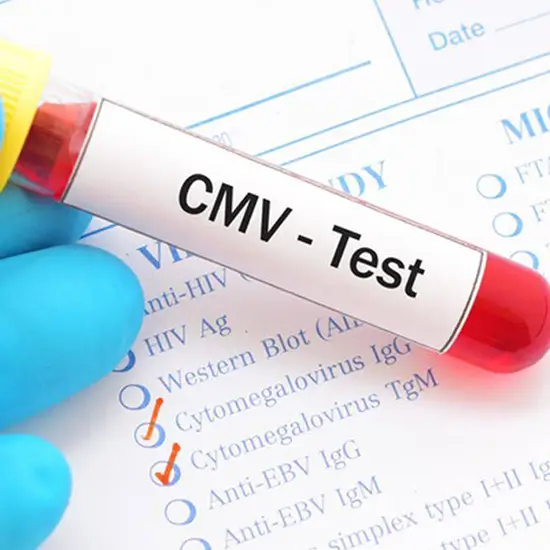 Cytomegalovirus (CMV) PCR Quantitative Test in Delhi NCR, India | GDIC