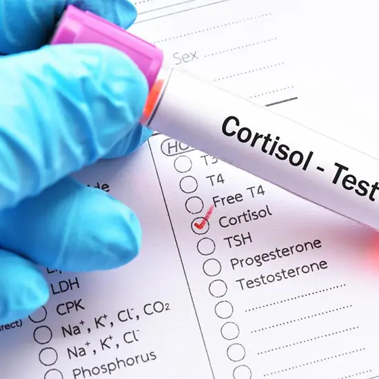 Book Cortisol | Test Price In Delhi | Ganesh Diagnostic