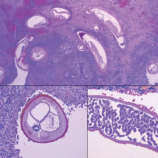 Microfilaria Antibody Test Near You in Delhi | Book Test at Low Price