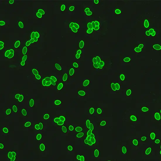 Book Anti Saccharomyces Cerevisiae Antibody Panel (ASCA) | Test Price ...