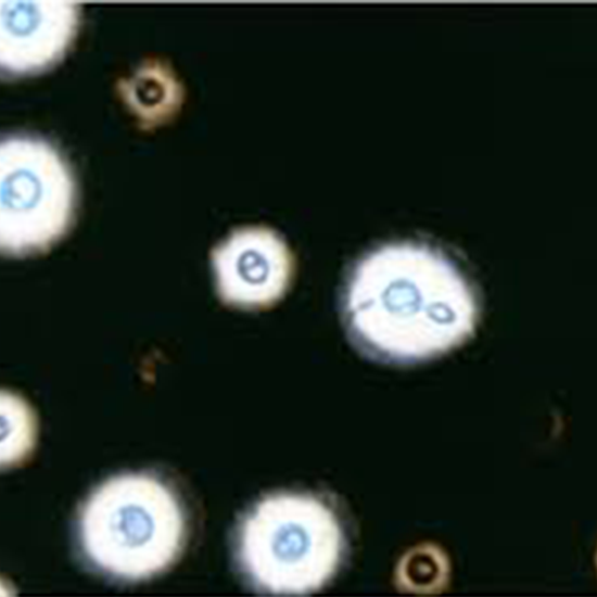 Cryptococcus Antigen CSF Test Near You in Delhi | Book Test at Low Price