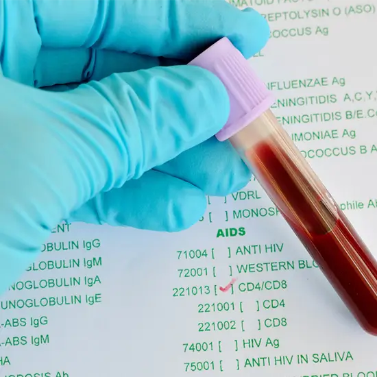 Book CD4 | Test Price In Delhi | Cost Near Me, India | Ganesh Diagnostic