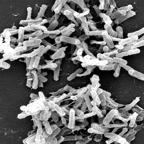 Clostridioides Difficile Toxin And A&B Stool | Test Price In Delhi ...